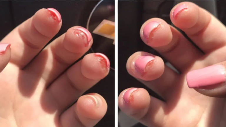 Heb jij (kunst) gelnagellak? Dit kan ernstige gevolgen hebben voor jouw ...